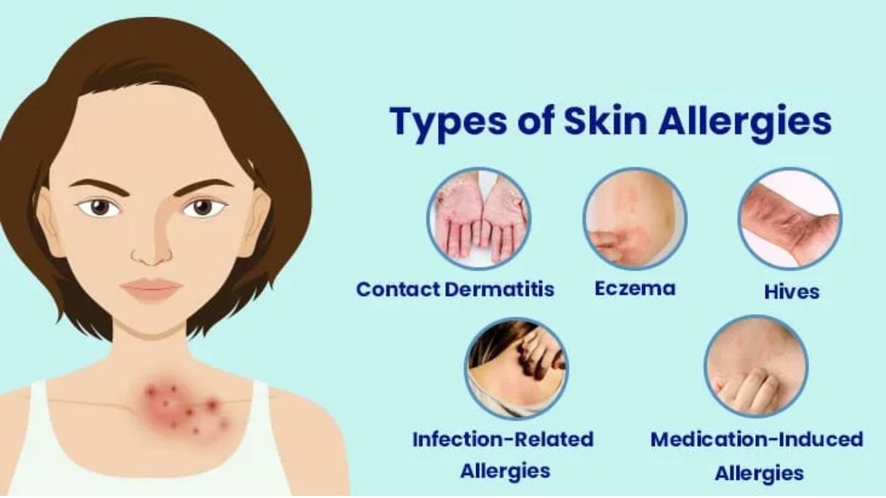 Ayurvedic Medicine for Skin Allergy Itching
